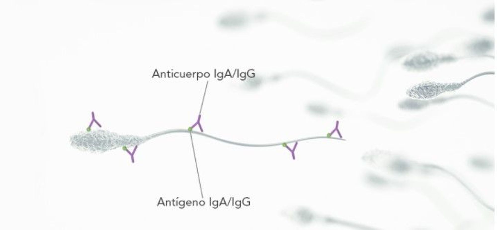 Le MAR-Test (Mixt Agglutination Reaction Test)